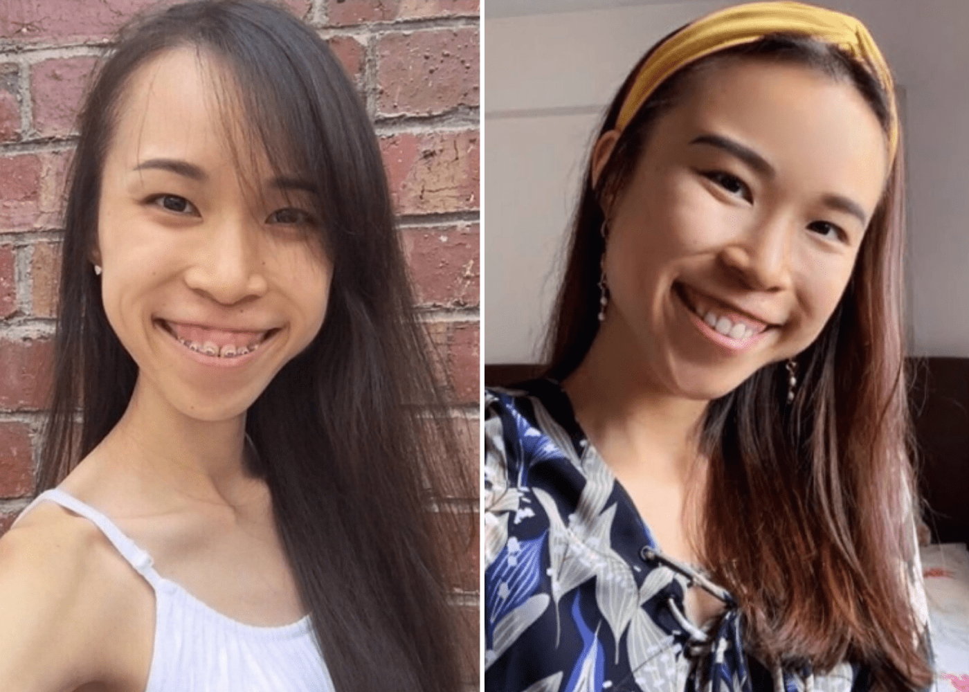 Overcoming an eating disorder: Nicole Tan’s journey | Honeycombers